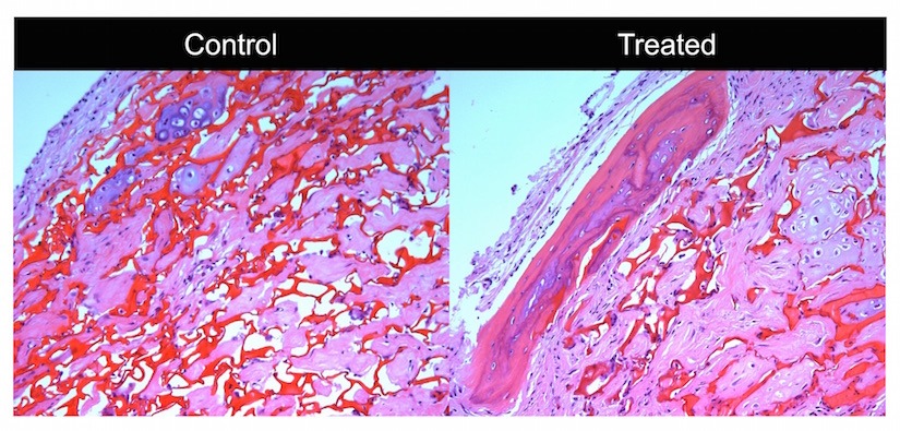 UW scientists find key cues to regulate bone-building cells - College ...