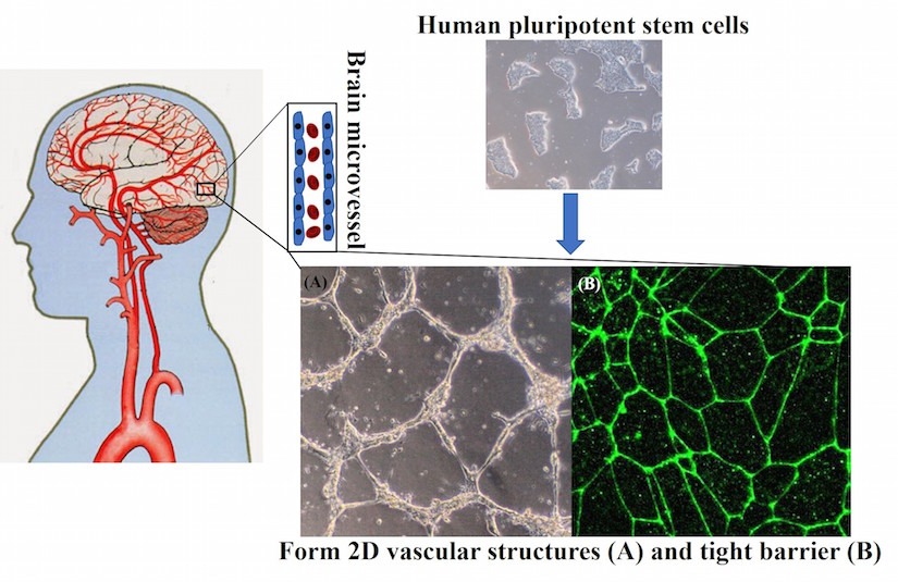 UW scientists create a recipe to make human blood-brain barrier ...