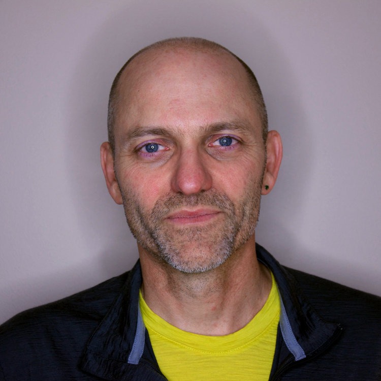 Bringing cheap and accurate tuberculosis tests to Africa - College of ...