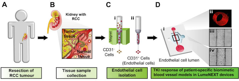 Beebe lab creates personalized in vitro model for kidney cancer drug ...