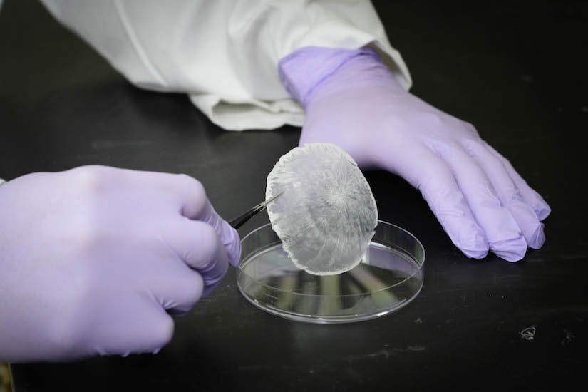 Resorbable biomaterial is major step toward implantable devices ...